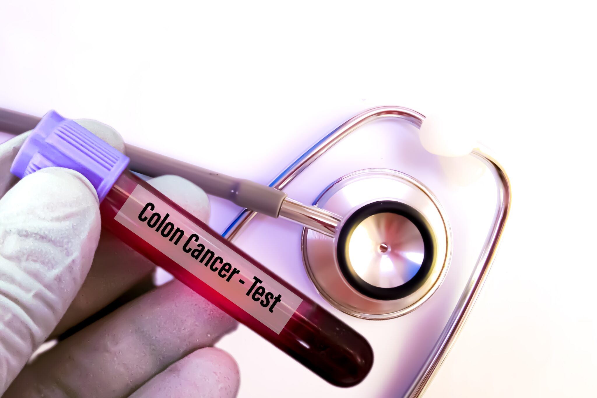 Colon Cancer Caused by Defective Drugs, Devices, and Products ...